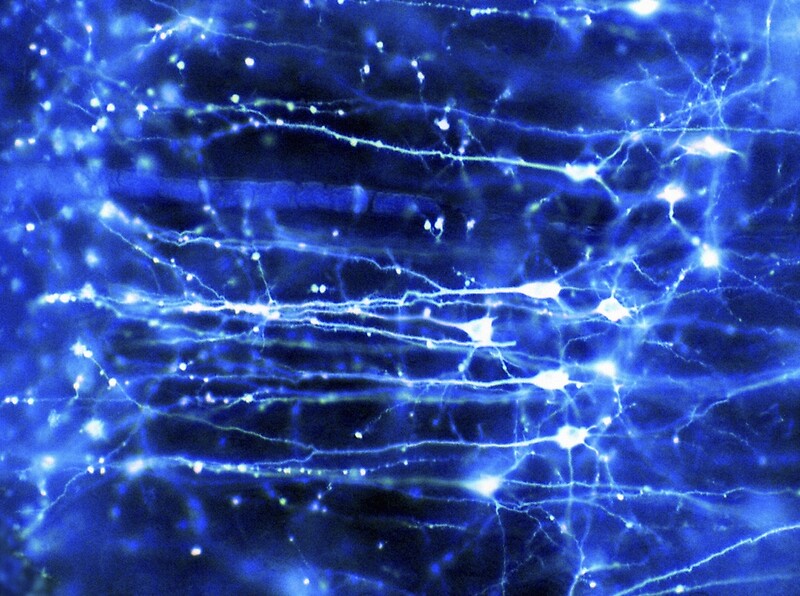 "Human Brain Synapses Electron Microscope Photo" by Stephen Chambers ...