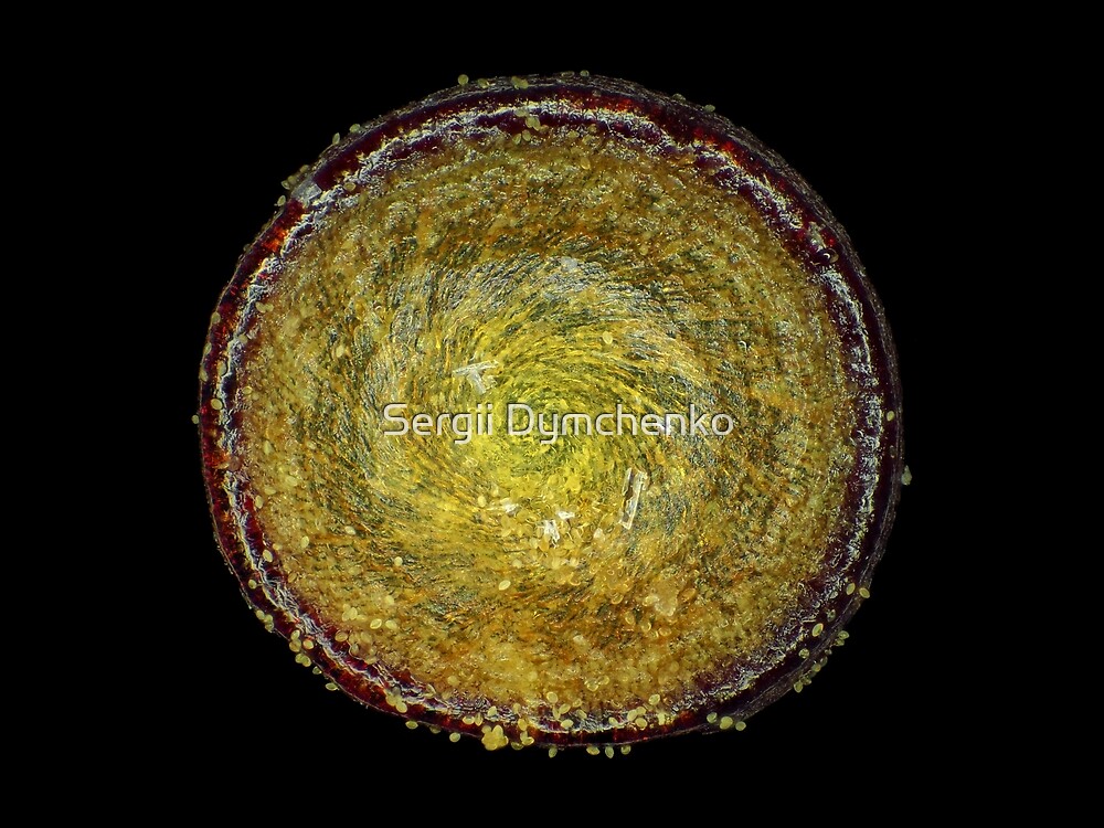 "Moss spore capsule lid under the microscope" by Sergii Dymchenko ...