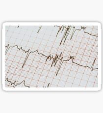 Ecg: Stickers | Redbubble