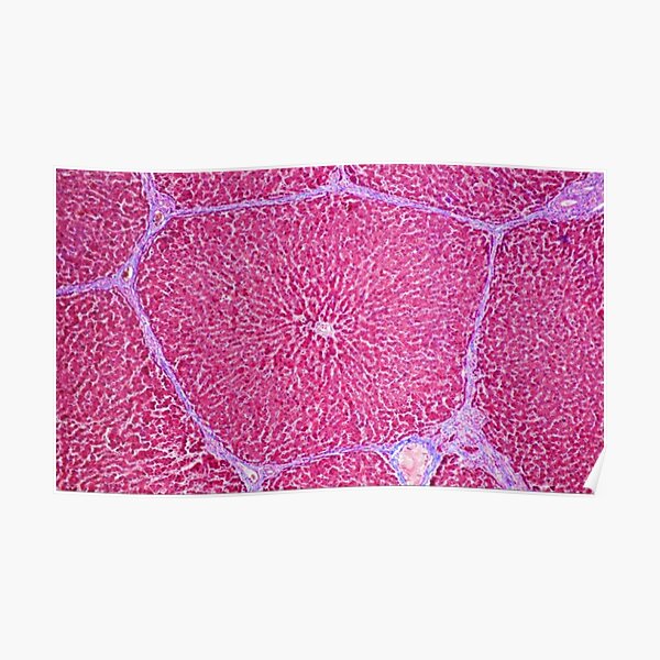 Tissue Posters | Redbubble