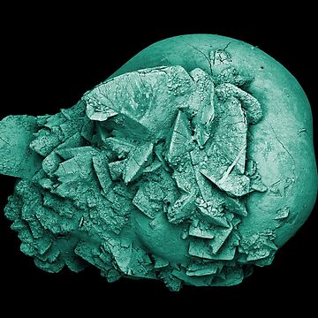 "Kidney stone, SEM (C036/9562)" Sticker for Sale by SciencePhoto ...