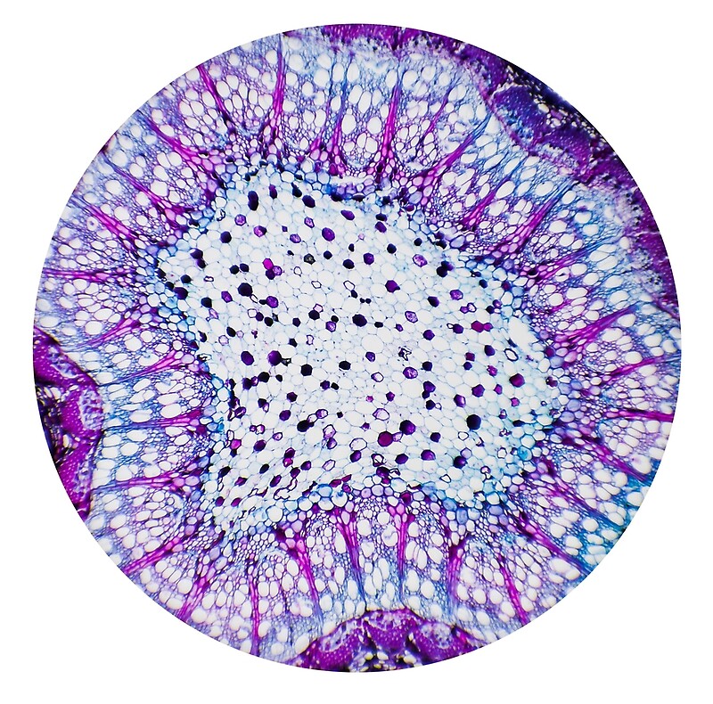 "Lenticel - Plant Stem Tissue - Microscopy Photograph" by DreamPieces ...