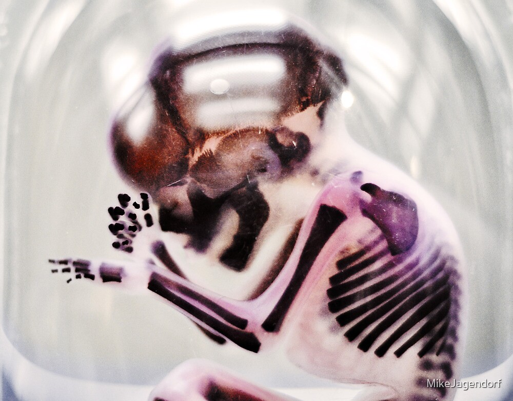 "Preserved Dyed Human Fetus" by MikeJagendorf | Redbubble