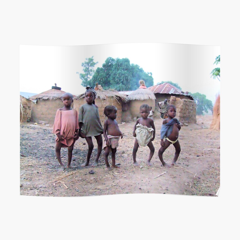 "Children with Rickets." Poster by joshuatree2 | Redbubble