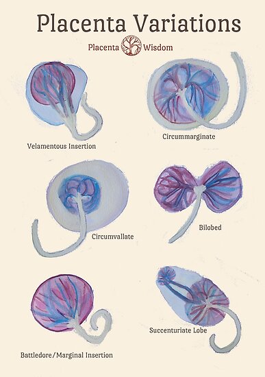 Different Types Of Placenta